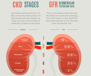 Stages of Kidney Disease and Risk Factors - Trust Multispeciality Hospitals